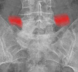 Becken / Hüfte Arzt | OrthoRad